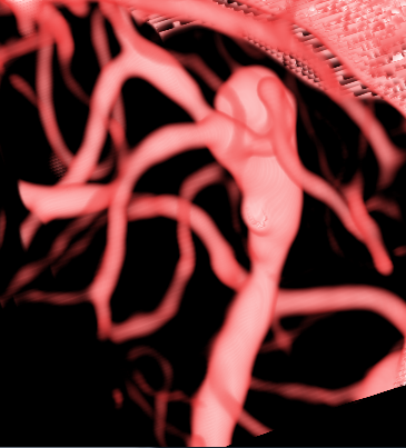 Vascular Visualization