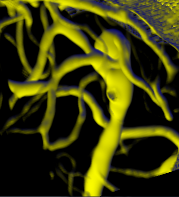 Vascular Visualization