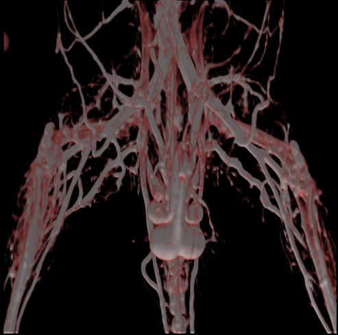 Vascular Visualization