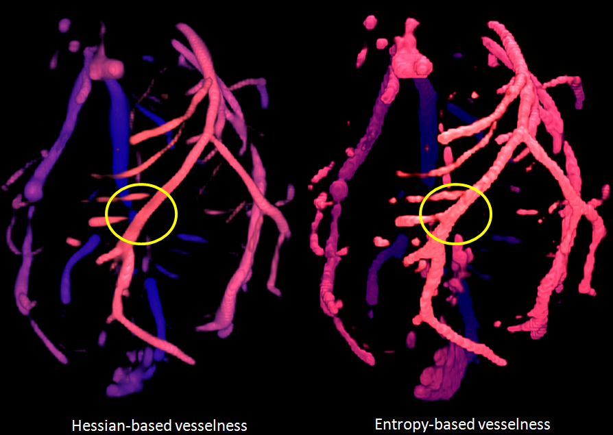 Vascular Visualization