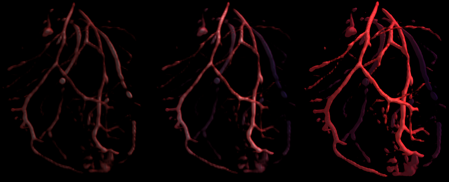Vascular Visualization