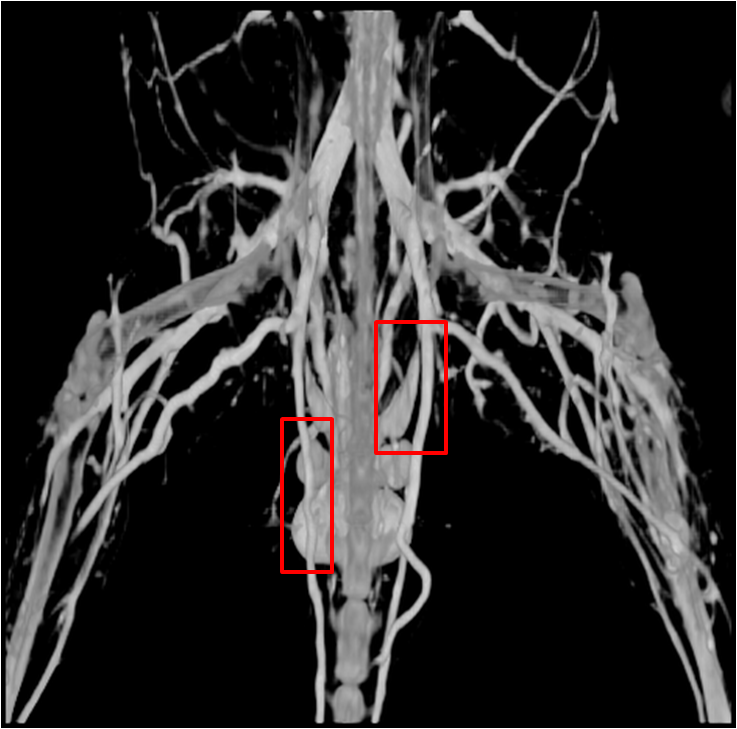 Vascular Visualization