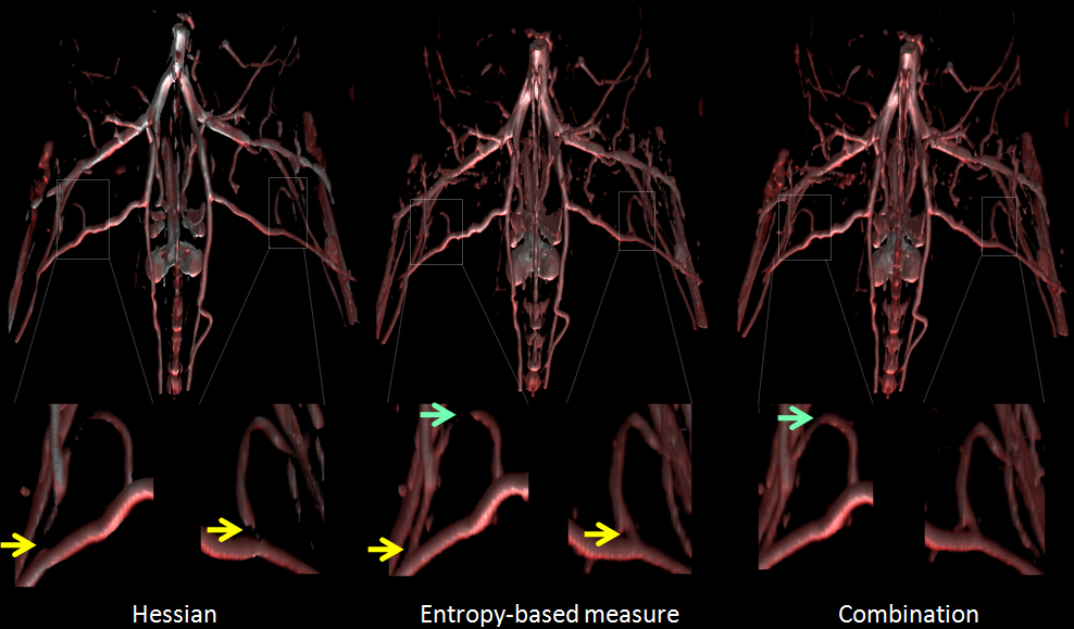 Vascular Visualization